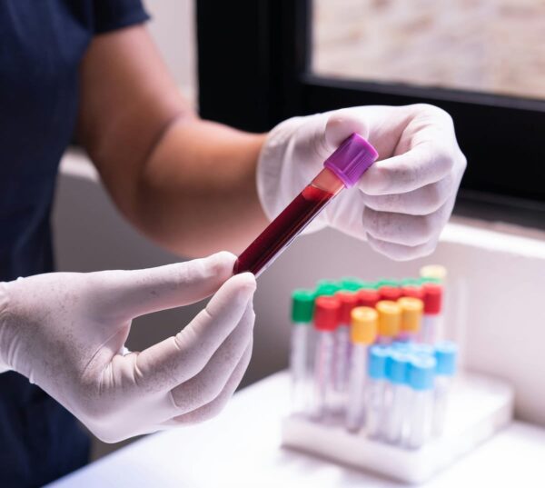 Post-Transplant Donor-Derived Cell-Free DNA Monitoring Products
