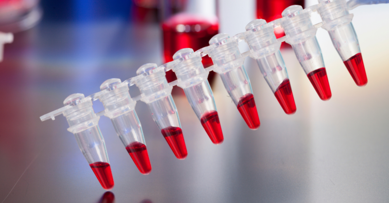 Application Guide: PBMC Isolation Best Practice with Lympholyte®-H